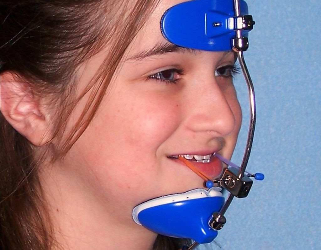 Headgear Braces- Different Types of Orthodontic Headgear