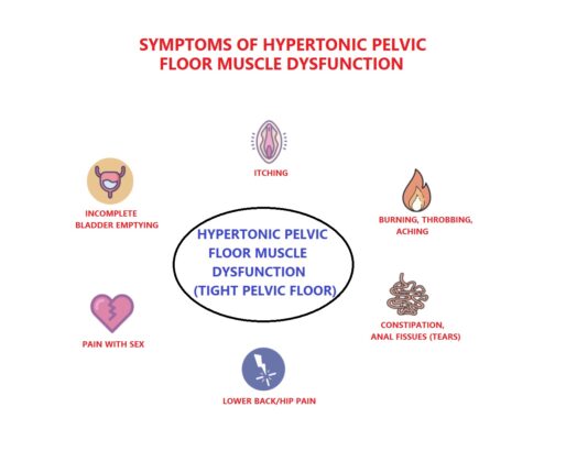 What is Hypertonic Pelvic Floor: Causes, Symptoms and Treatment - fixthelife